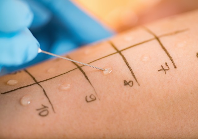 RACGP - Allergy management for NT GPs